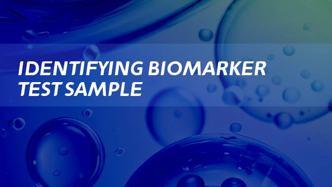 Identifying the Right Samples: A Guide to Metabolomics Biomarker ...