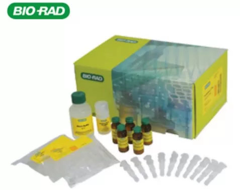 Key Protein Extraction Techniques for Biological Fluids in Proteomics ...