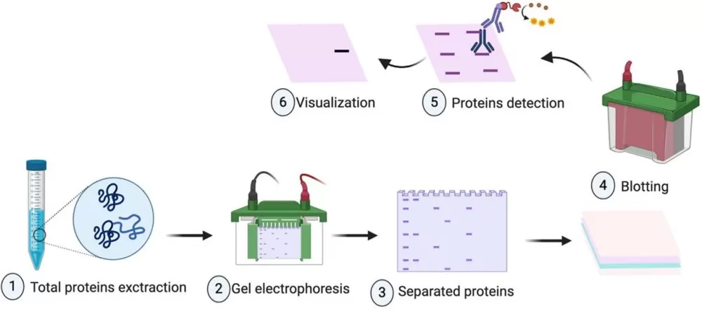 Mastering Western Blot: A Step-by-Step Guide from Sample to Signal ...