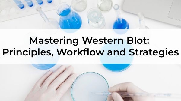 Mastering Western Blot: Principles, Workflow and Essential Optimization ...