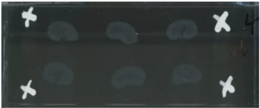Tissue Sampling, Embedding, Sectioning, Preservation and Transport ...
